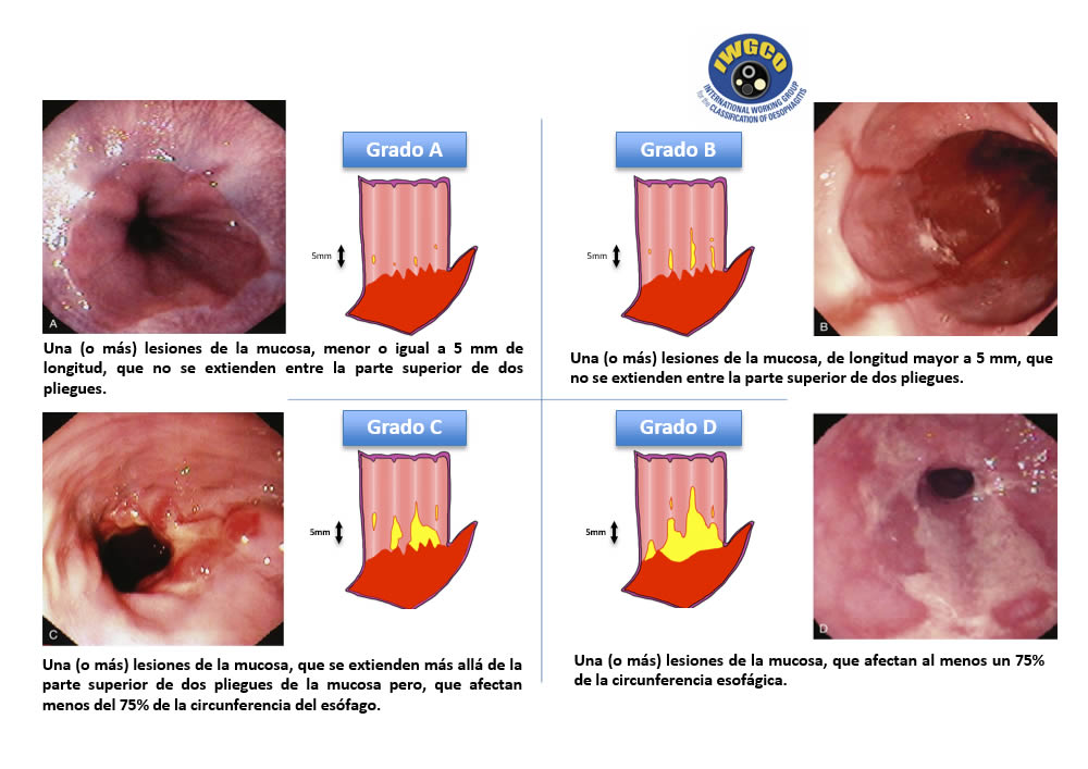 ENDIBA - Herramientas para Endoscopistas
