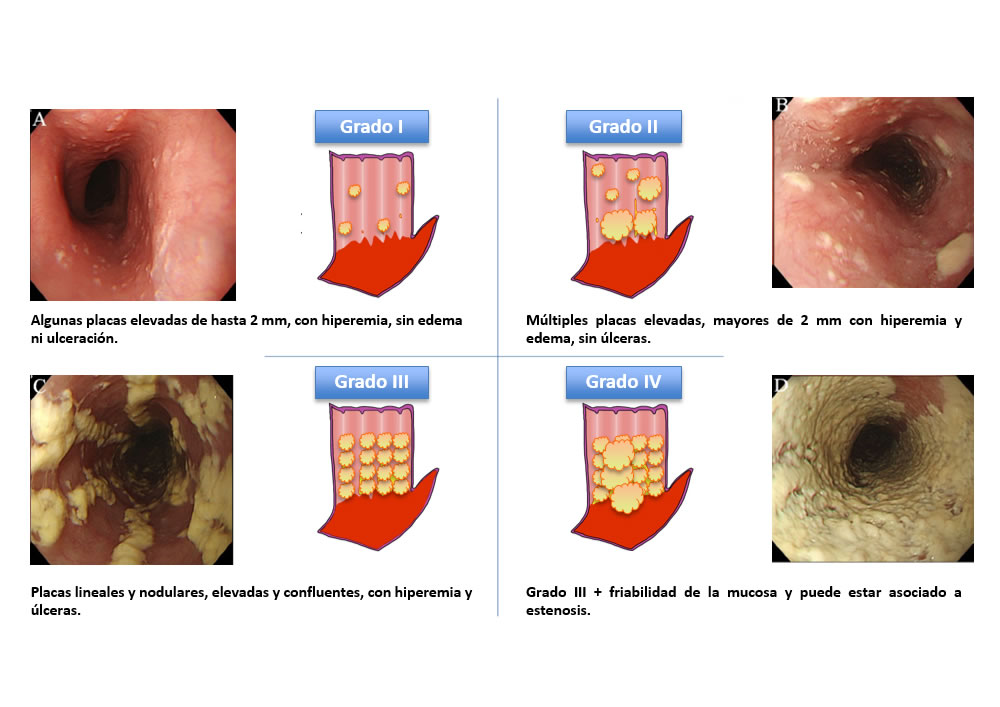 ENDIBA - Herramientas para Endoscopistas